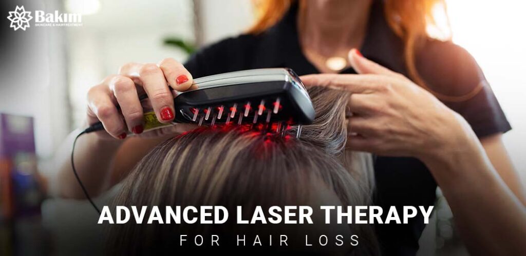 Advanced Laser Therapy for Combatting Hair Loss - Bakim